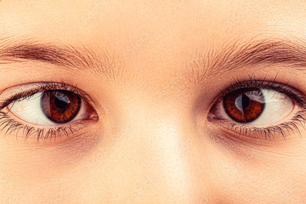 Parents Vision Therapy – Virginia Vision Therapy Center
