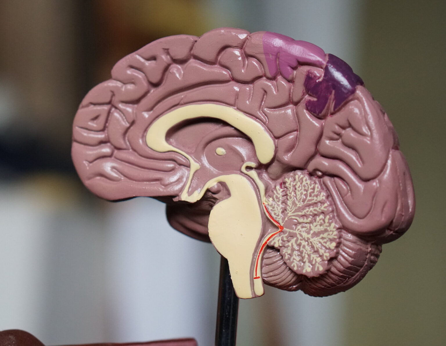 Optometric Multi-Sensory Training – Virginia Vision Therapy Center